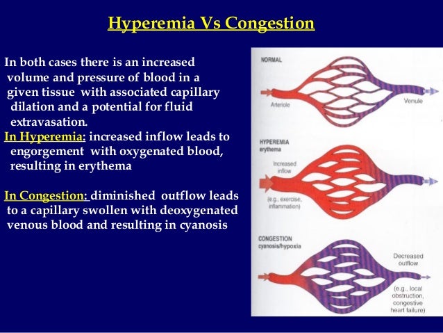 Haemodynamic disorders , thromboembolism and shock by Dr Nadeem (RMC)