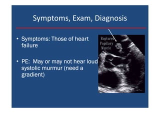 Haemodynamic Instability in STEMI | PDF