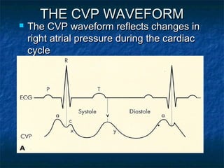 Haemodynamic monitoring | PPT
