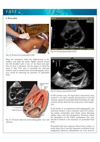 Haemodynamics | PDF