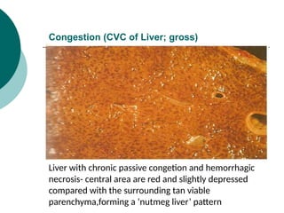 Haemodynamics and shock powerpoint presentation | PPTX