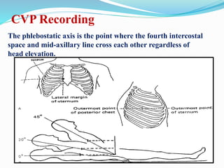 Haemodynamic wave forms | PPTX