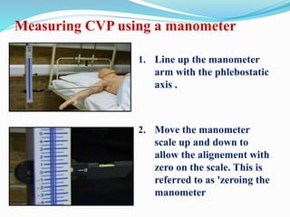 Haemodynamic wave forms | PPTX