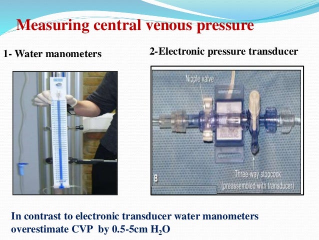 Haemodynamic wave forms