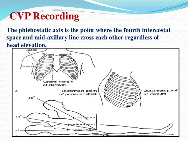 Haemodynamic wave forms