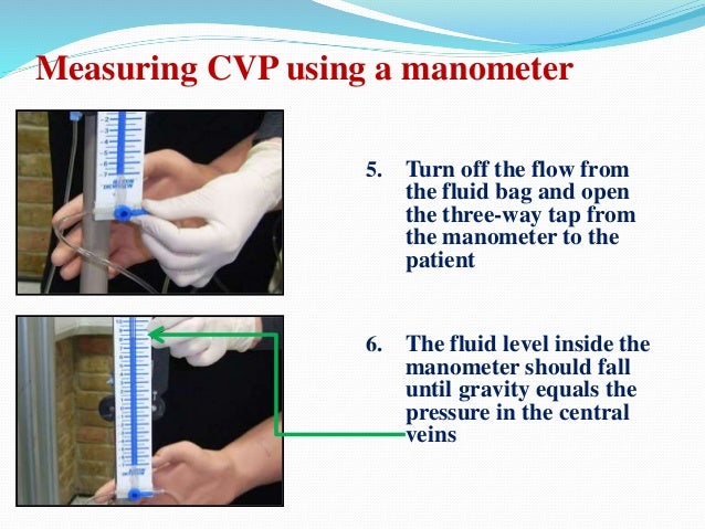 Haemodynamic wave forms
