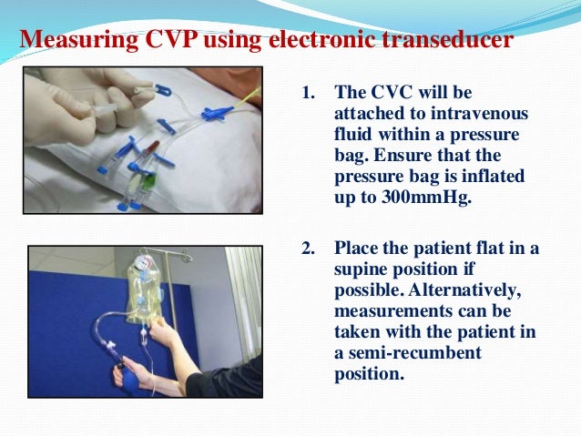 Haemodynamic wave forms