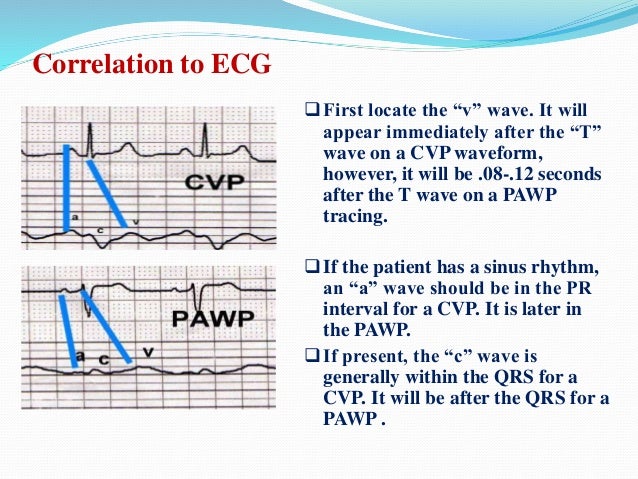 Haemodynamic wave forms
