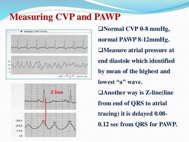 Haemodynamic wave forms