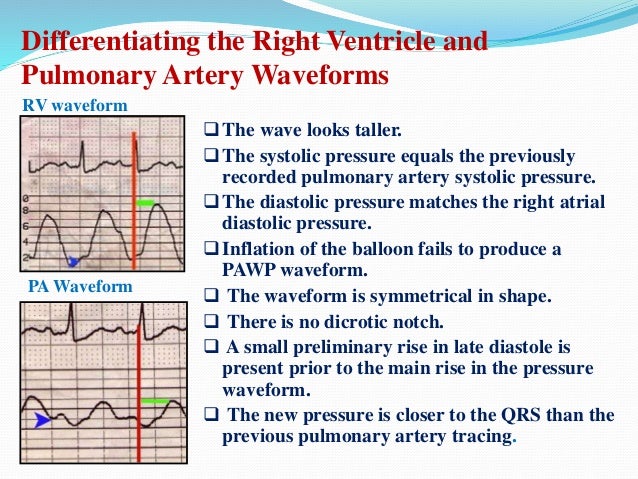 Haemodynamic wave forms