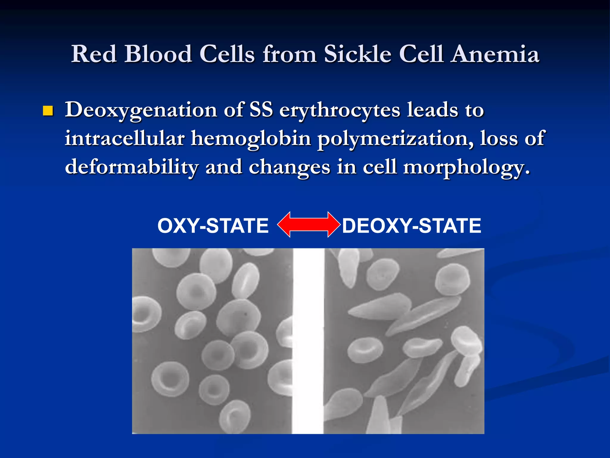 Haemoglobinopathies sickle cell anemia | PPTX