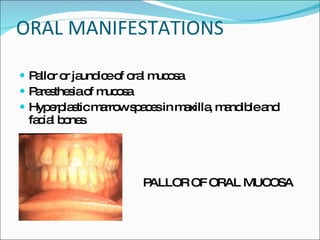 Haemolytic Anaemias in dentistry | PPT