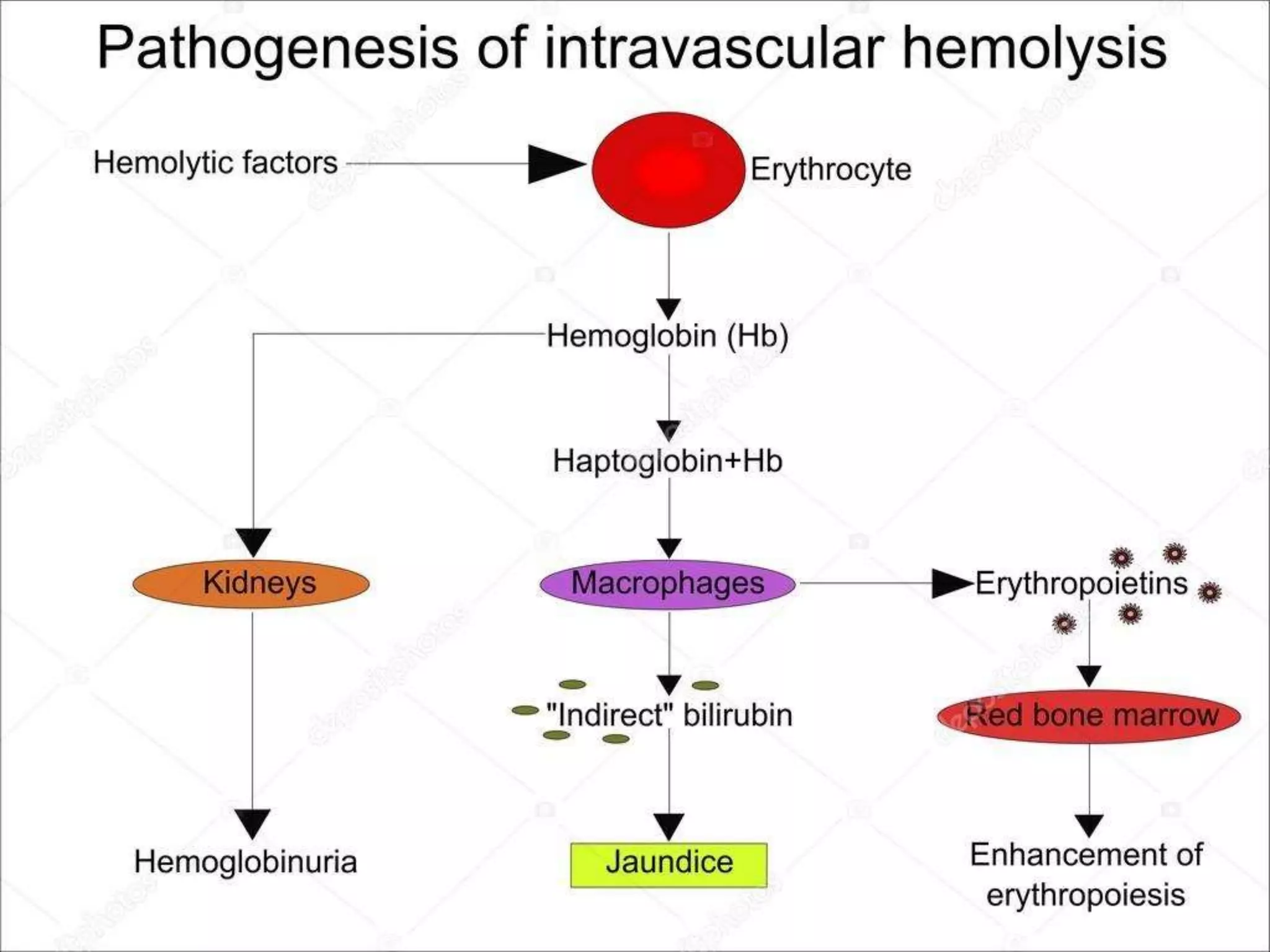 Haemolytic anemia | PPTX | Blood Disorders | Diseases and Conditions