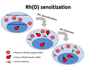 HAEMOLYTIC DISEASE OF THE NEW BORN (HDN).pptx