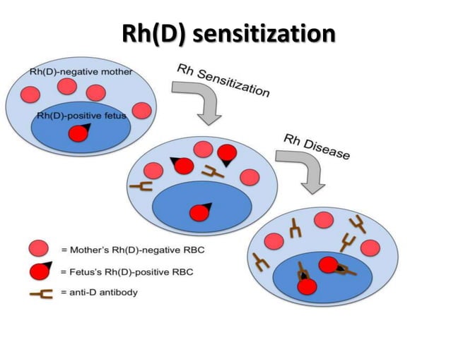 HAEMOLYTIC DISEASE OF THE NEW BORN (HDN).pptx | Pregnancy ...