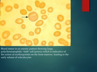Haemolytic disorders | PPT