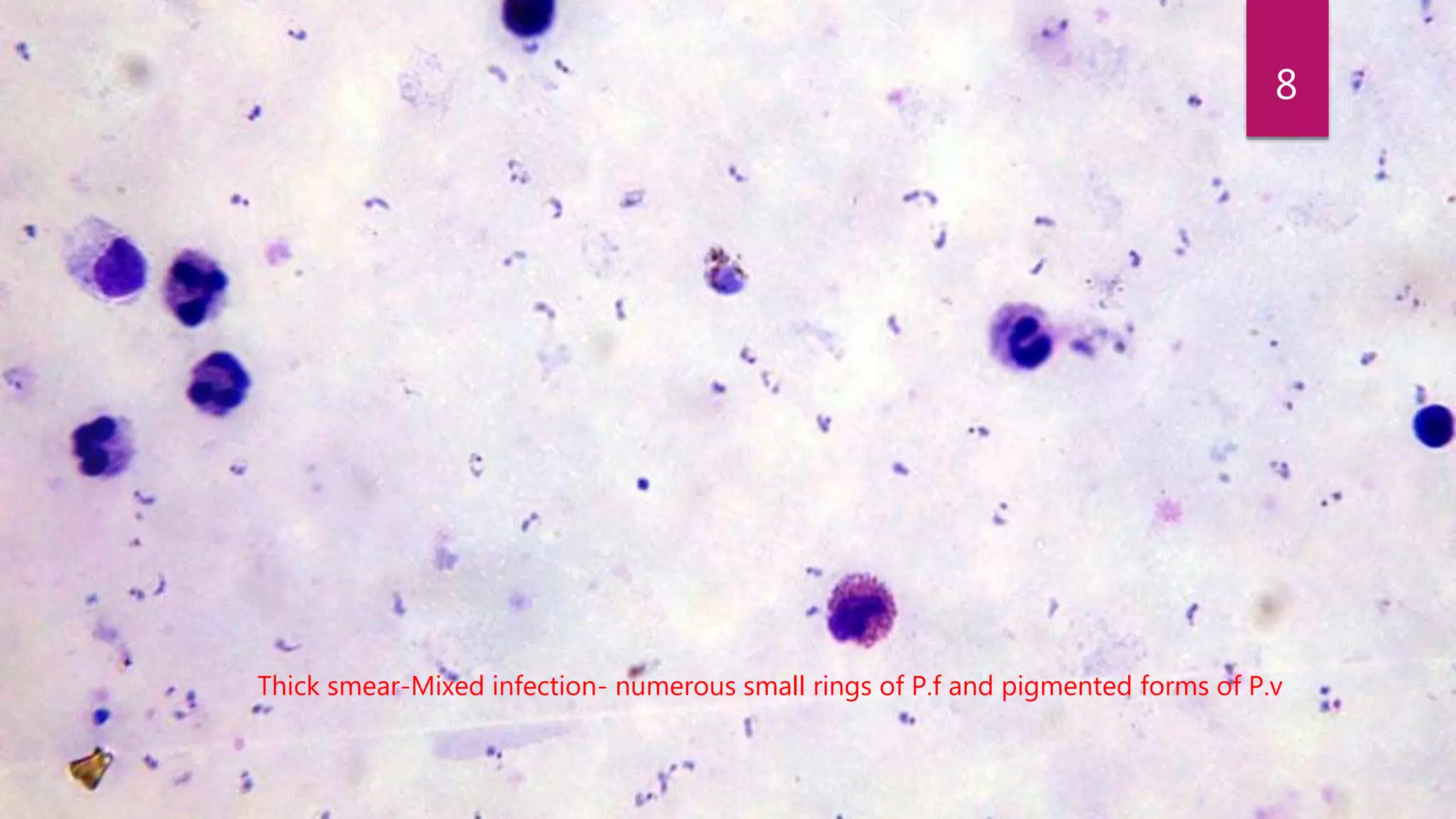 Haemoparasites in blood smear | PPTX