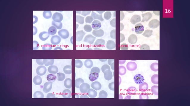 Haemoparasites in blood smear | PPTX | Blood Disorders | Diseases and ...