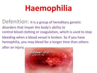 Haemophilia | PPTX | Blood Disorders | Diseases and Conditions