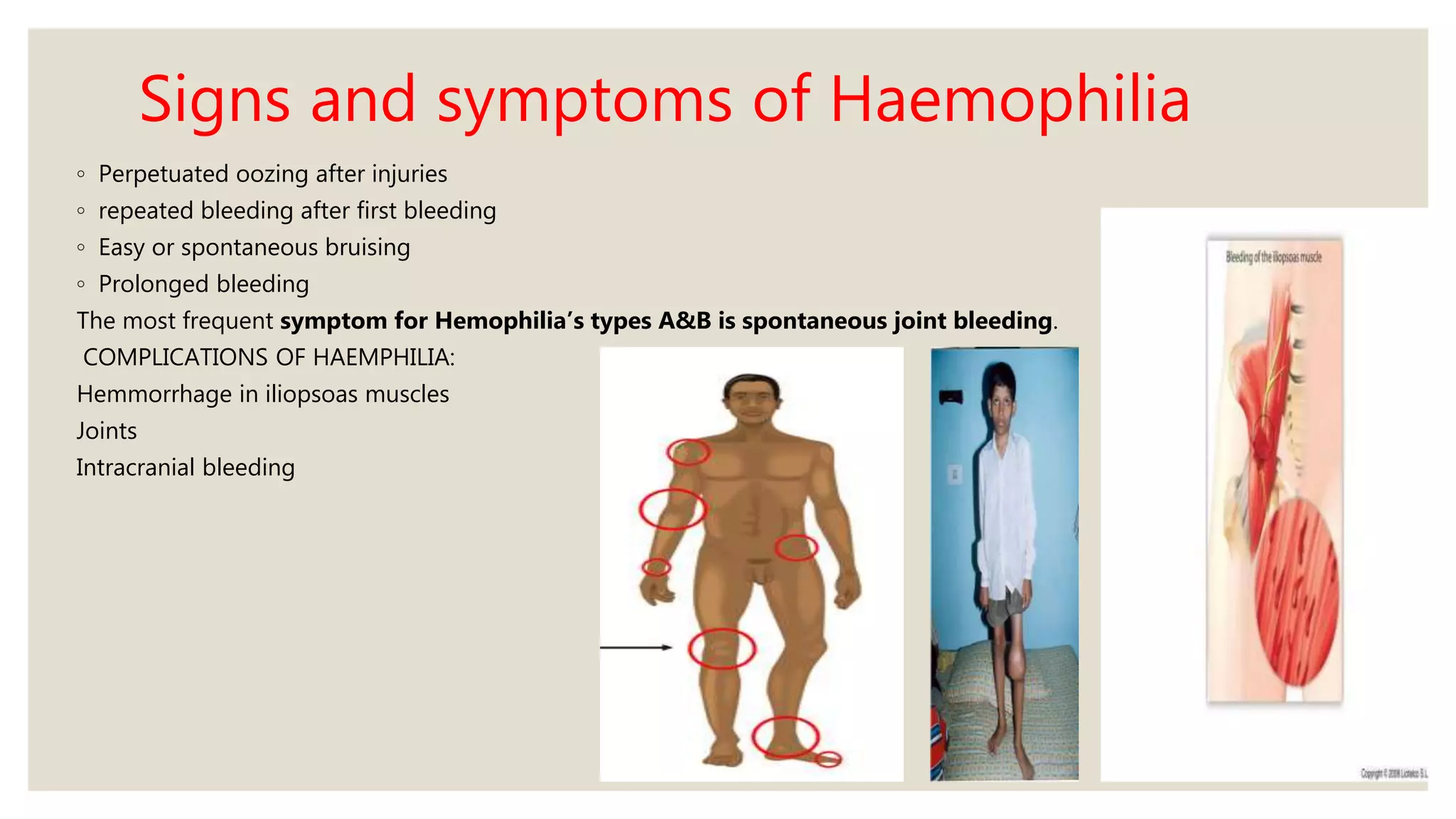 Haemophilia | PPTX