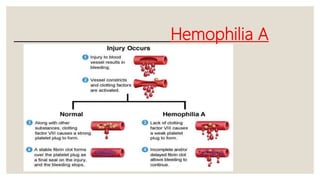 Haemophilia | PPTX