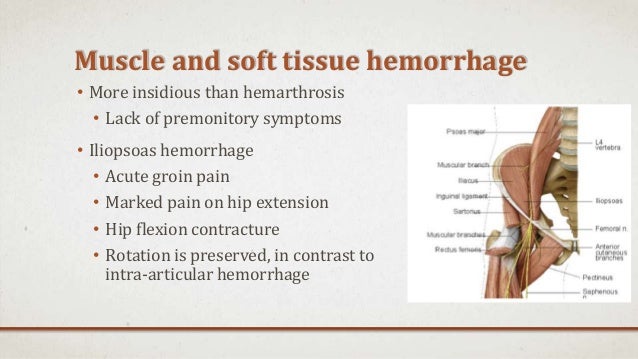 Haemophilic Arthropathy (PMR)