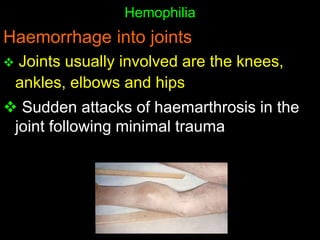 Haemophilic arthritis1 | PPT
