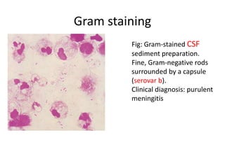 Haemophilus Gram Stain