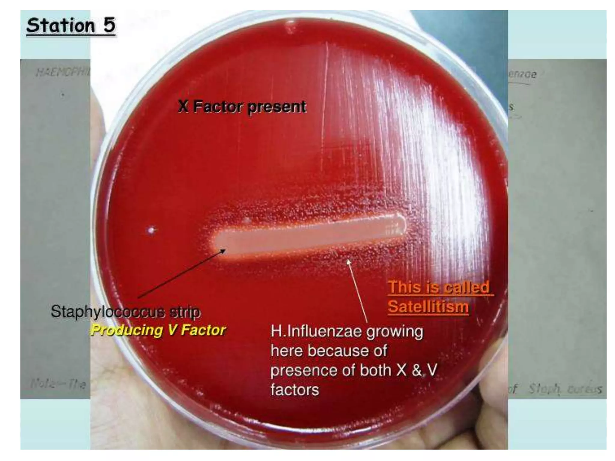 Haemophilus species | PPTX