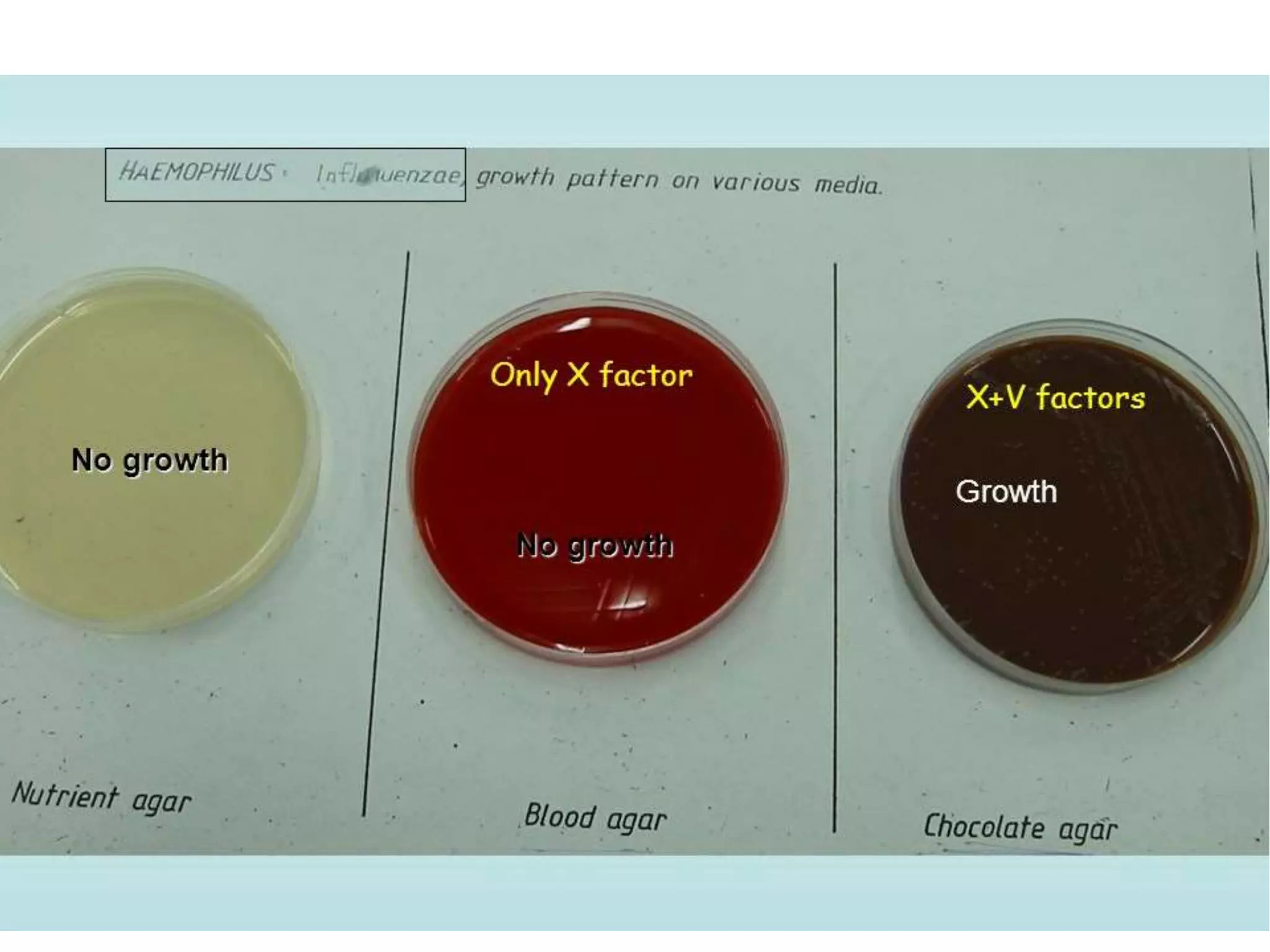 Haemophilus species | PPTX