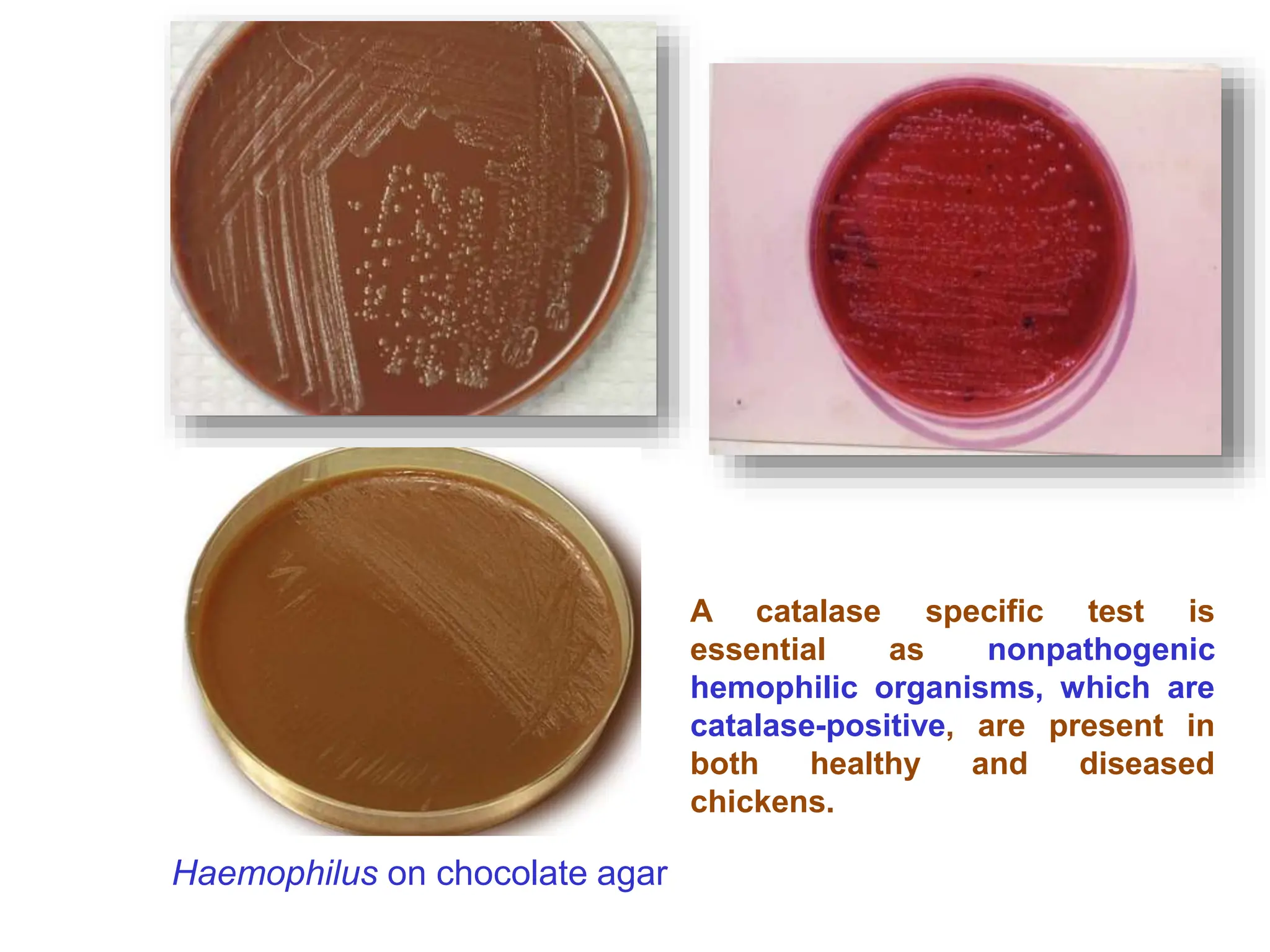 Haemophilus.ppt BACTERIOLOGY Haemophilus | PPT