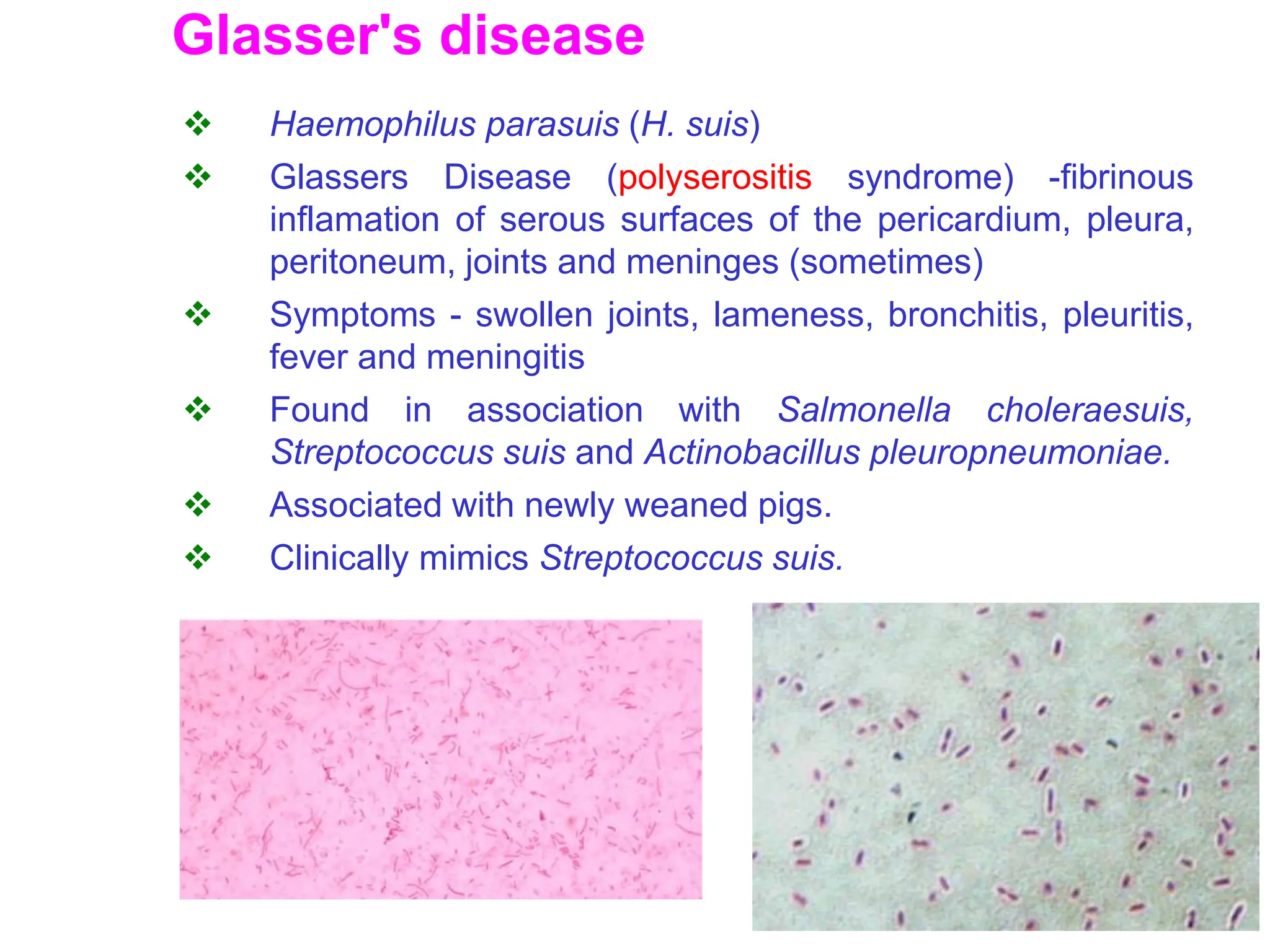 Haemophilus.ppt BACTERIOLOGY Haemophilus | PPT