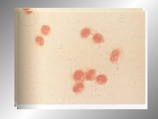 Haemophilus --all sps | PPT