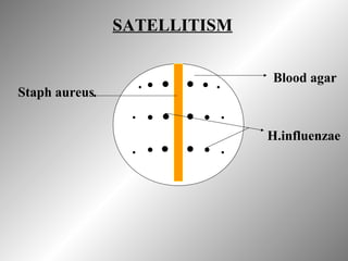 Haemophilus --all sps | PPT