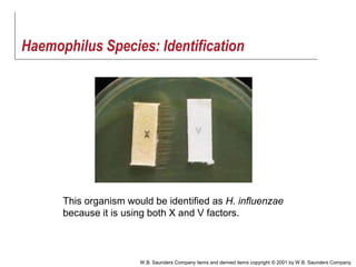Haemophilus and other fastidious gram negative rods /certified fixed ...