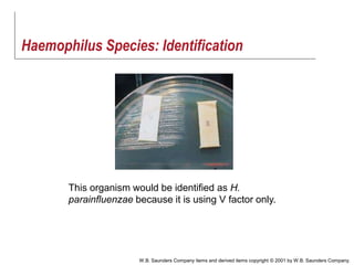 Haemophilus and other fastidious gram negative rods /certified fixed ...