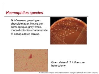 Haemophilus and other fastidious gram negative rods /certified fixed ...
