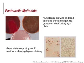 Pasteurella Multocida Gram Stain