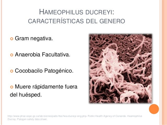 Haemophilus ducreyi y Klebsiella Granulomatis
