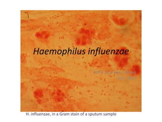 Haemophilus influenzae | PPTX