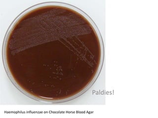 Haemophilus influenzae | PPTX