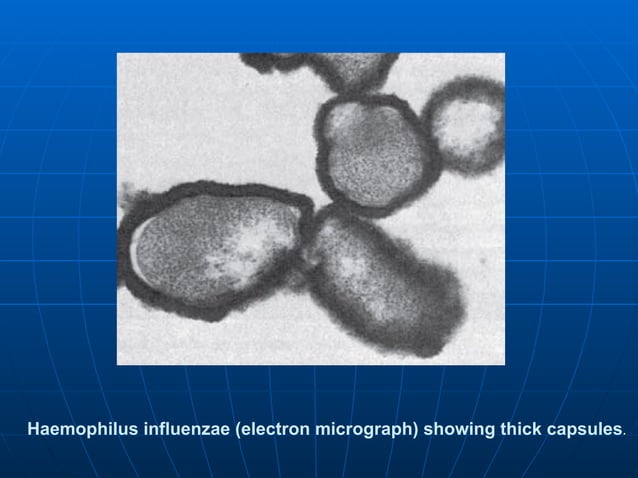 Haemophilus influenzae.ppt................ | PPT