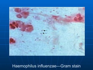 Haemophilus influenzae.ppt................ | PPT