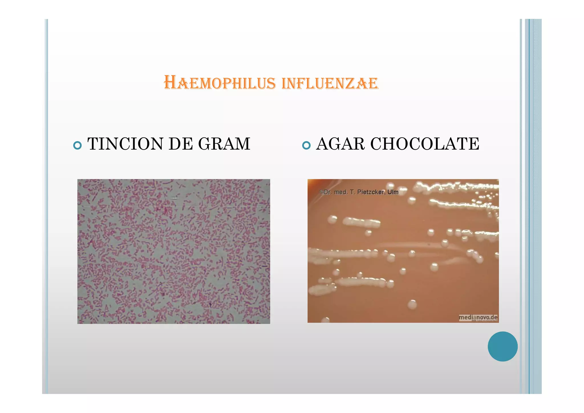 Haemophilus Influenzae Y Otros Haemophilus Spp Exposicion [Modo De ...