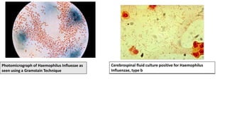 Haemophilus influenza powerpoint | PPTX