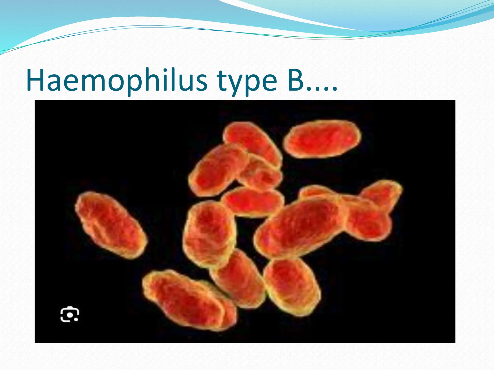 HAEMOPHILUS type b.and it's causes and how it affects | PPTX
