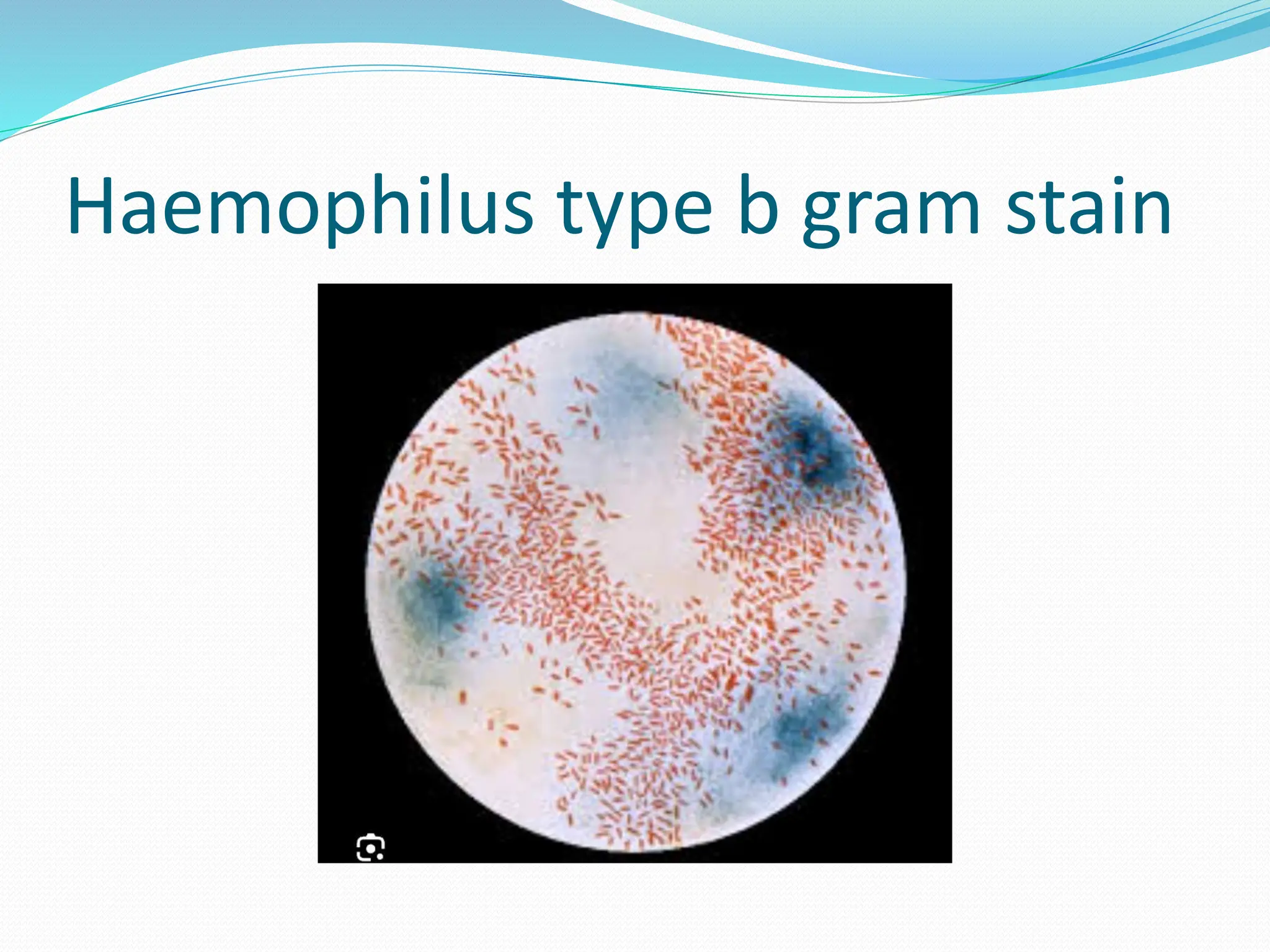 HAEMOPHILUS type b.and it's causes and how it affects | PPTX