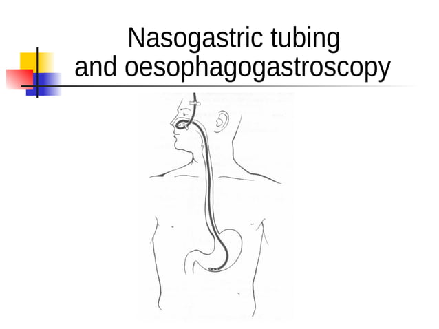 Haemorhage surgical diesease in depth detail | PPT