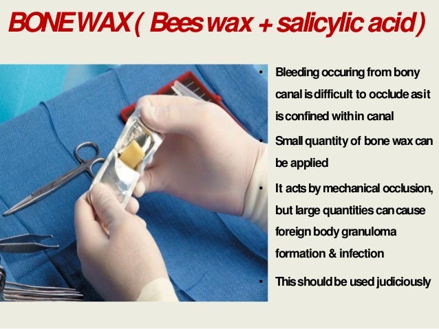 Haemorrhageandshock ppt veeru