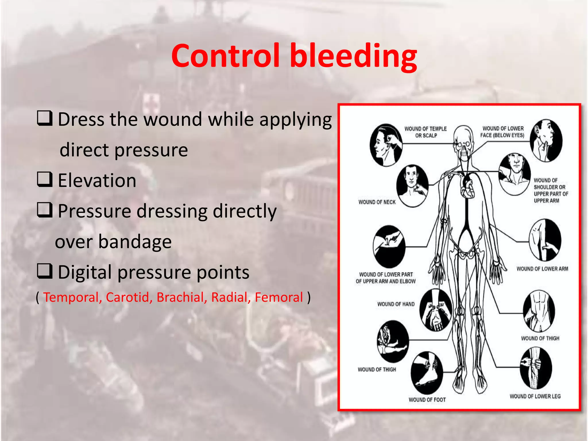 Haemorrhage control in combat | PPTX